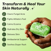 Loravey® AntiFungal Relief Soap Bar – Luvira